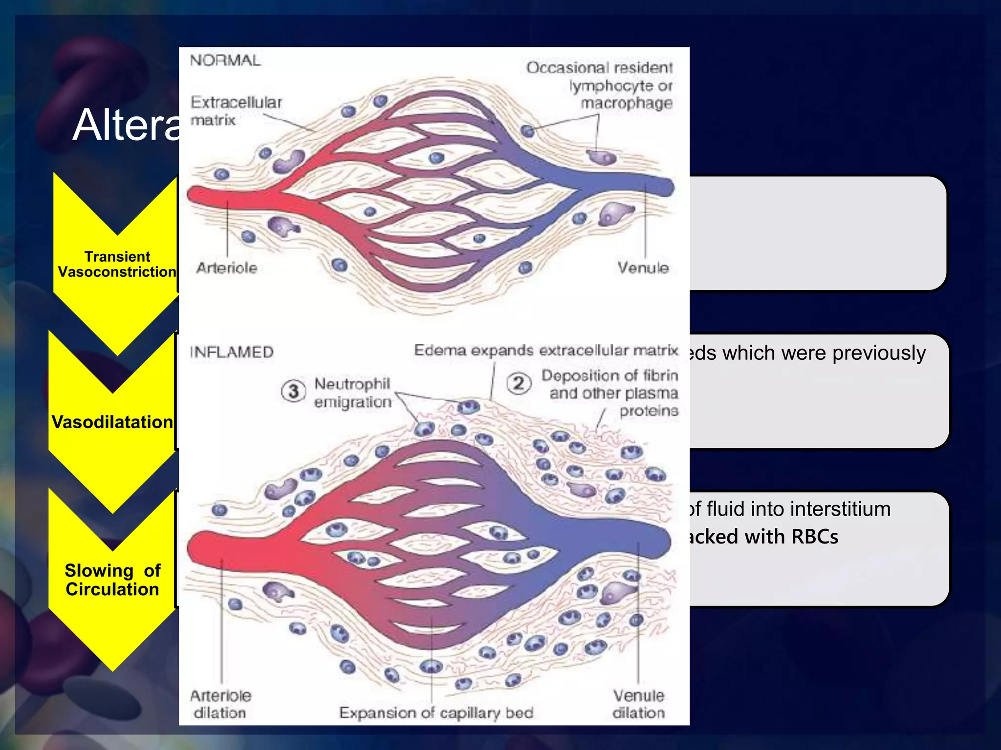 Definition, types & vascular events of inflammation | PPTX