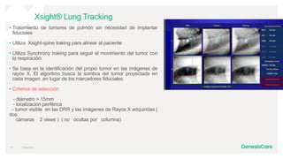 SBRT robotizada (Cyberknife) Tumores pulmonares | PPTX
