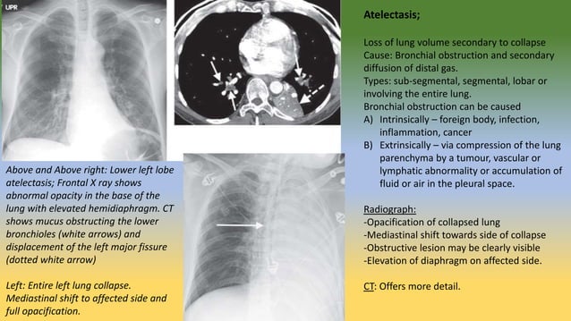 Basic Radiology for Third Year Medical students | PPT