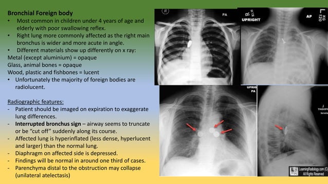 Basic Radiology for Third Year Medical students | PPT