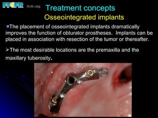 Definitive obturation treatment concepts | PPT