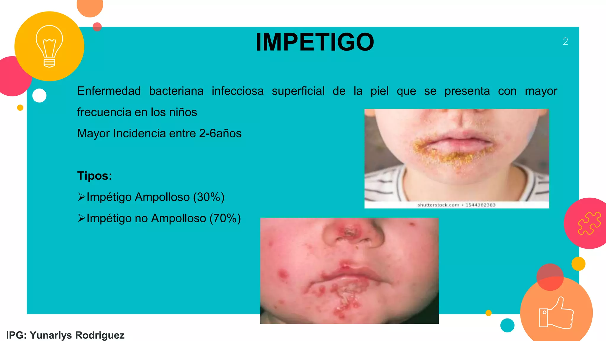 Infección Superficial de Piel y Partes Blandas | PPTX