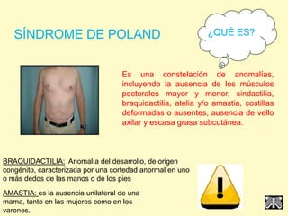 Deformidades toracicas | PPTX