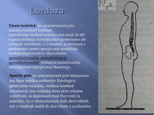 Deformațiunile coloanei vertebrale. | PPTX