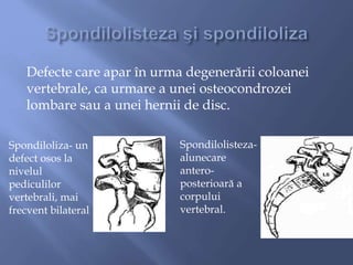 Deformațiunile coloanei vertebrale. | PPTX