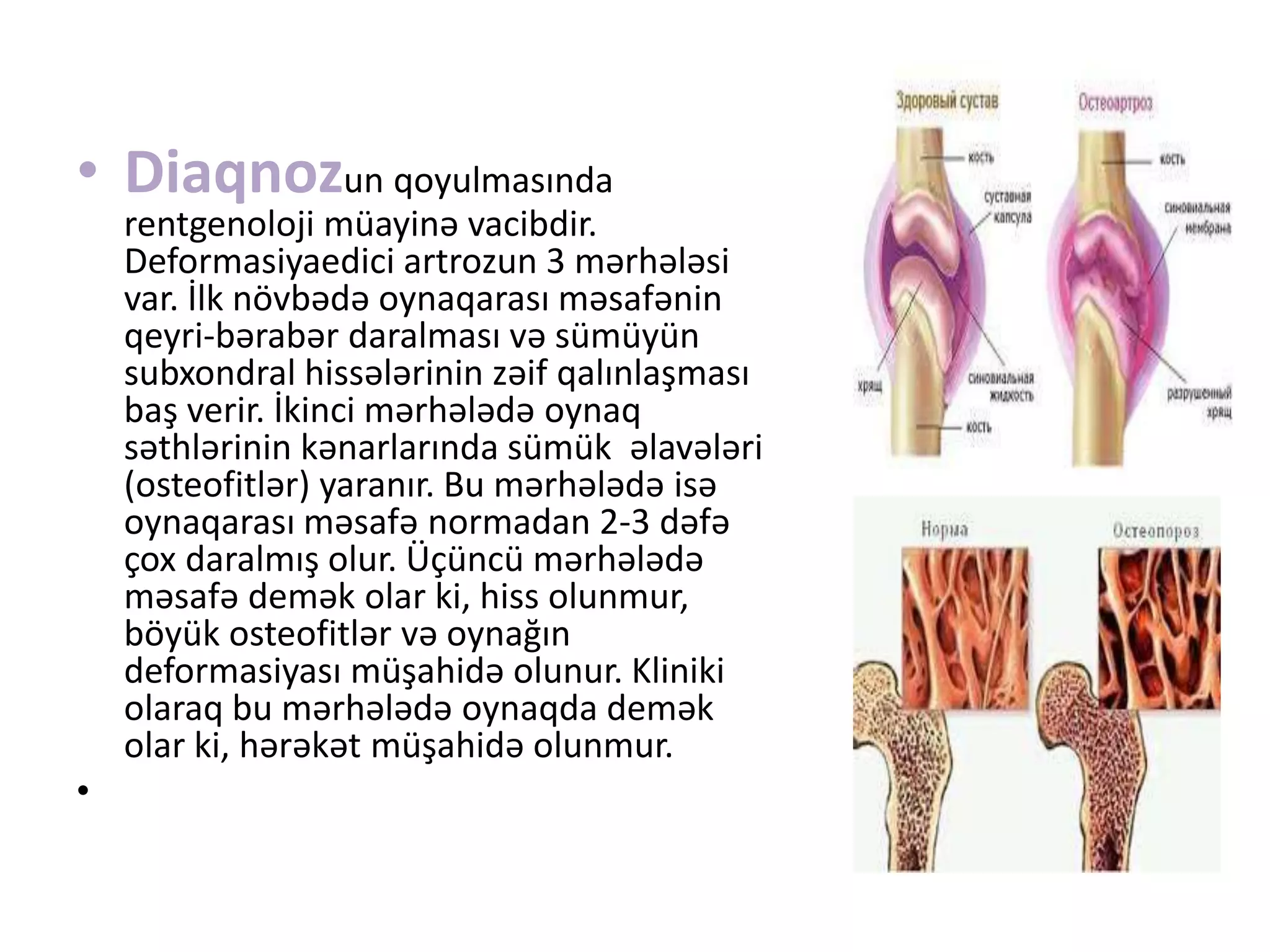 Deformasi̇yaedi̇ci̇ osteoartroz | PPTX