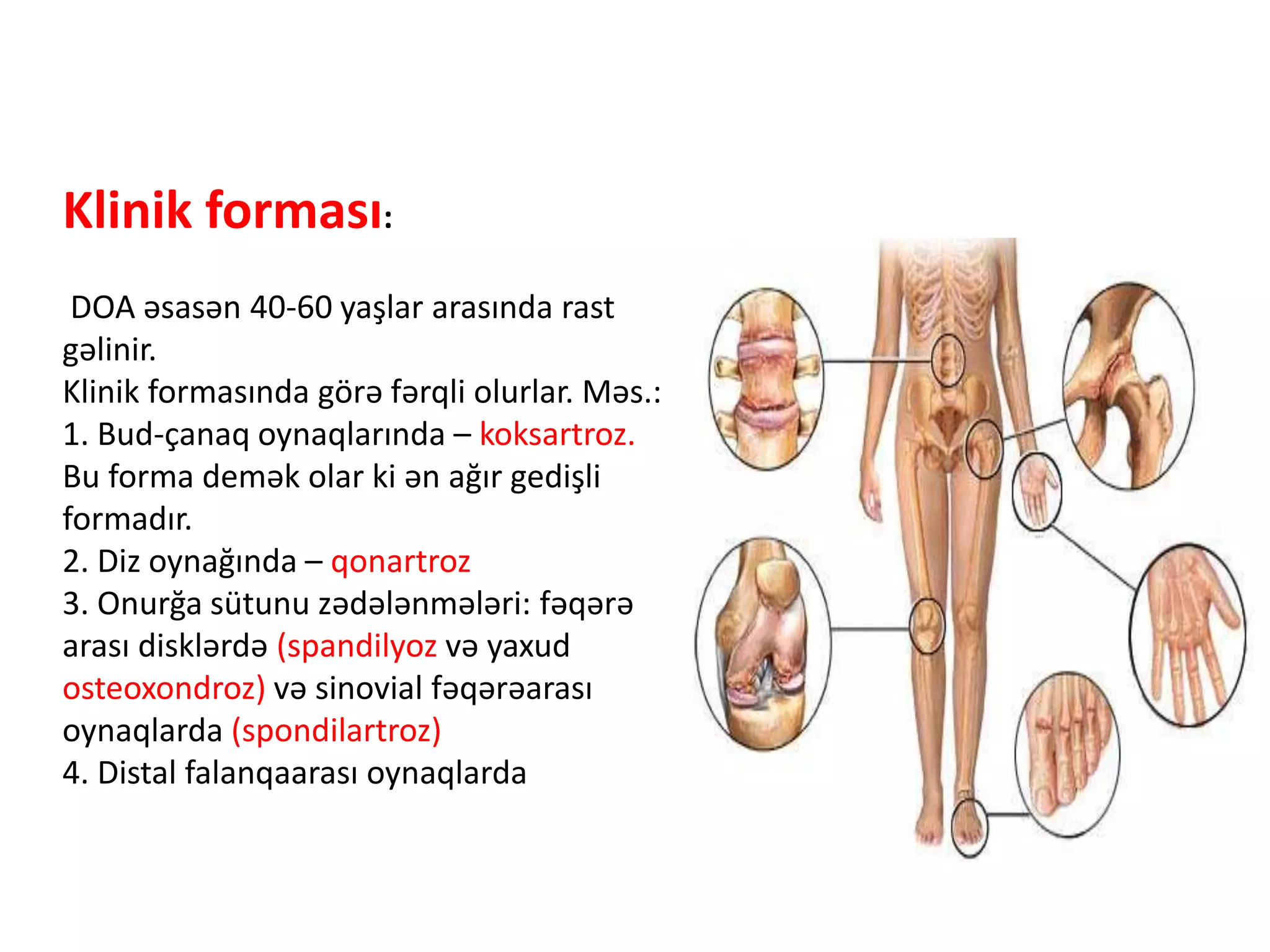 Deformasi̇yaedi̇ci̇ osteoartroz | PPTX