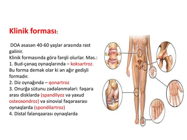 Deformasi̇yaedi̇ci̇ osteoartroz | PPT