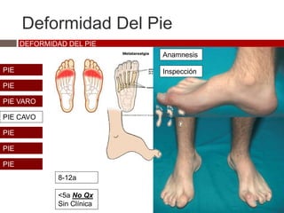 Deformidades del pie | PPTX