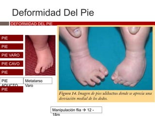 Deformidades del pie | PPTX