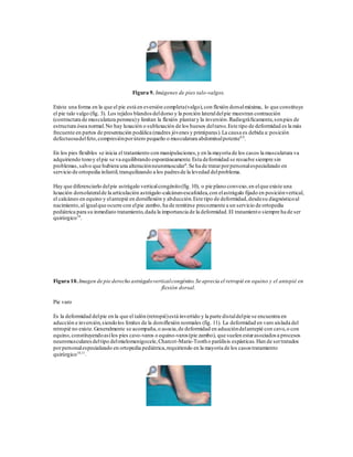 Deformidades del pie | DOCX