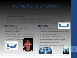 Deformidades dentofaciales y asimetrias faciales | ODP
