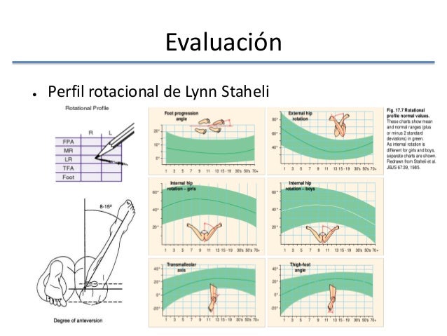 Deformidades rotacionales de los miembros inferiores