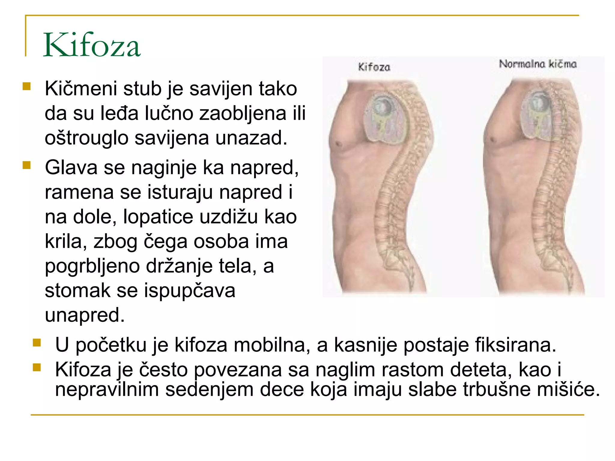 Deformiteti skeleta | PPT