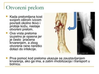 Deformiteti skeleta | PPT