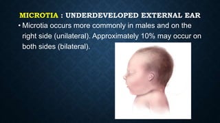 Deformities of ear | PPTX