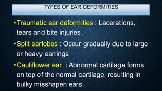 Deformities of ear | PPTX