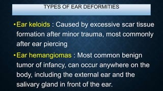 Deformities of ear | PPTX