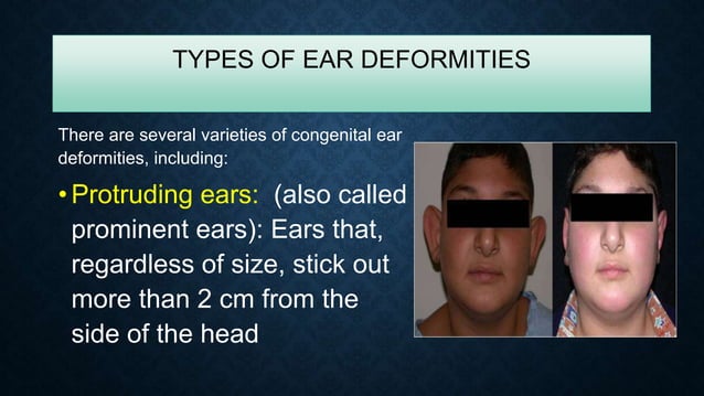 Deformities of ear | PPTX