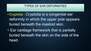 Deformities of ear | PPTX