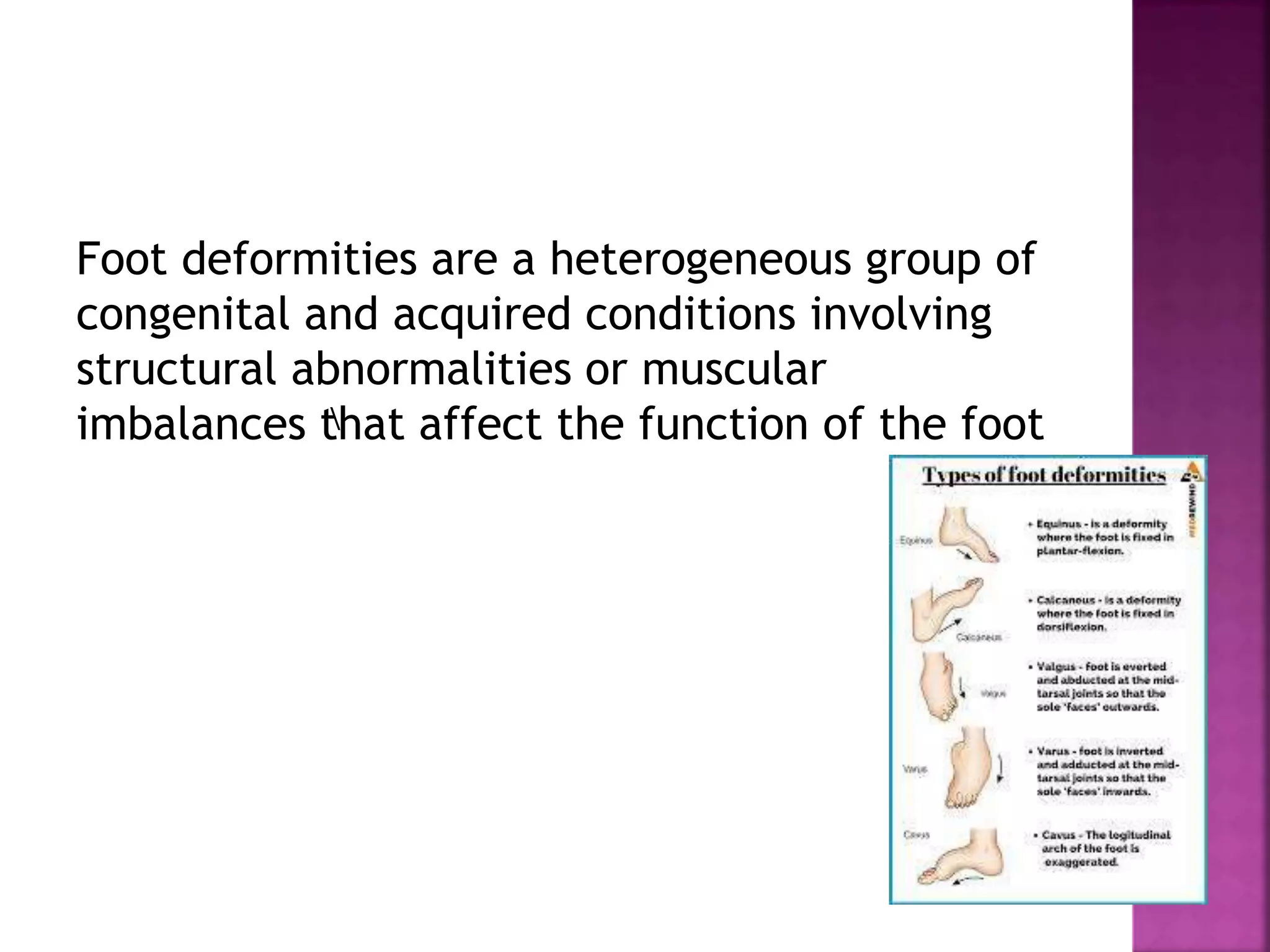 DEFORMITIES OF FOOT.pptx