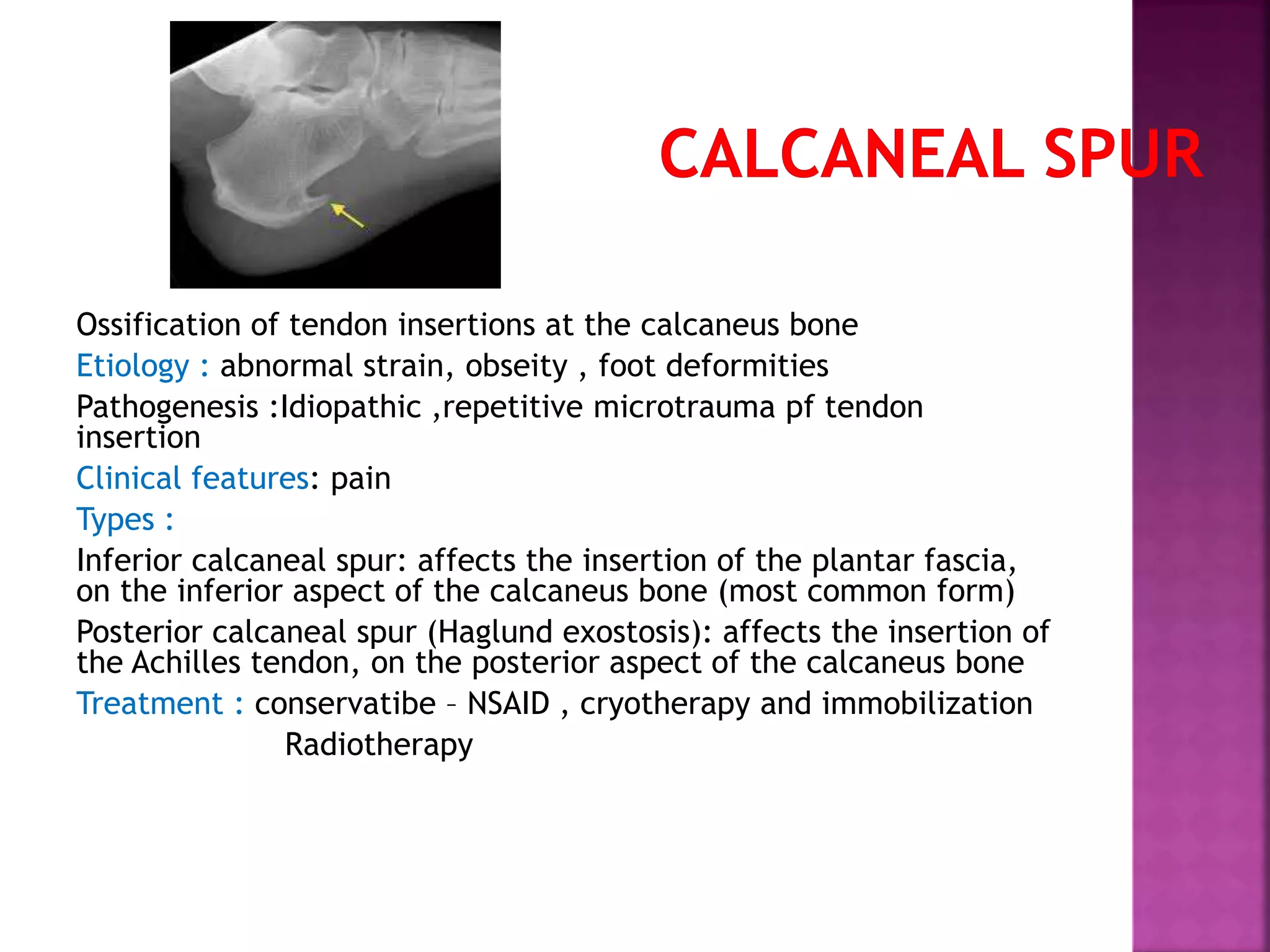DEFORMITIES OF FOOT.pptx