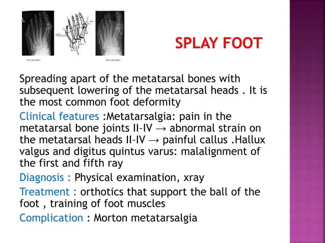 DEFORMITIES OF FOOT.pptx