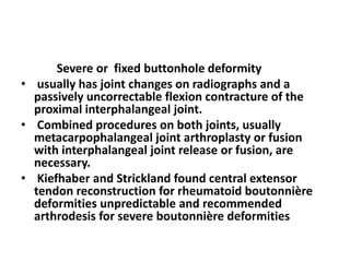Deformities of hand in rheumatoid arthritis | PPTX