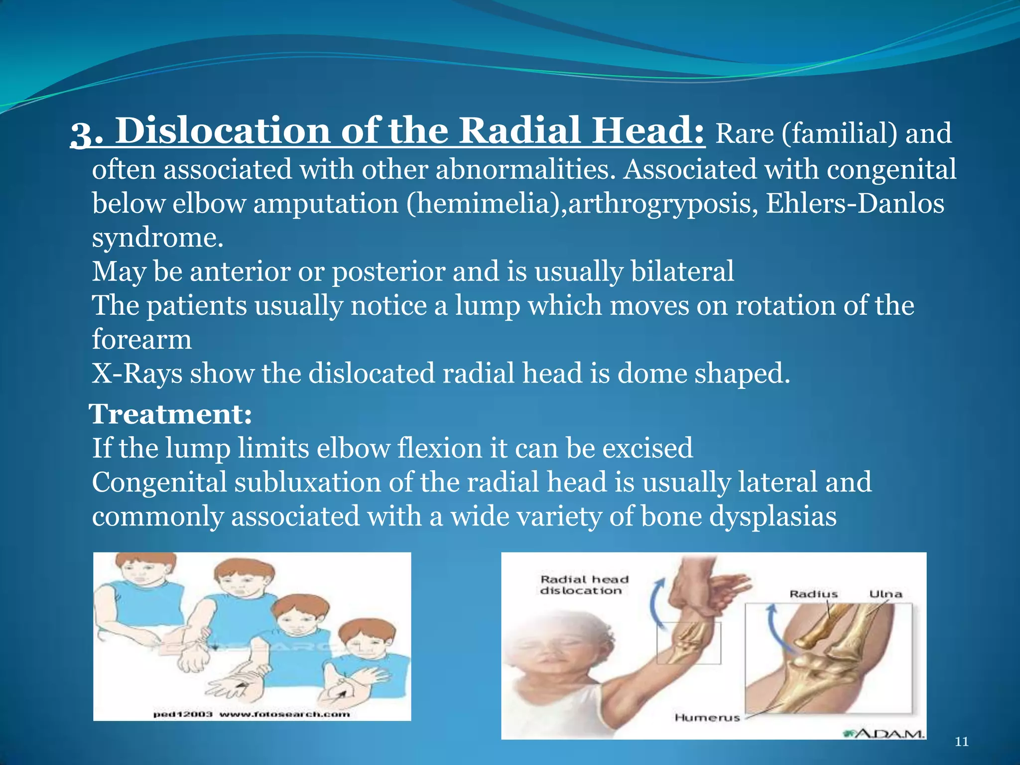 Deformities Of Human Body | PPTX