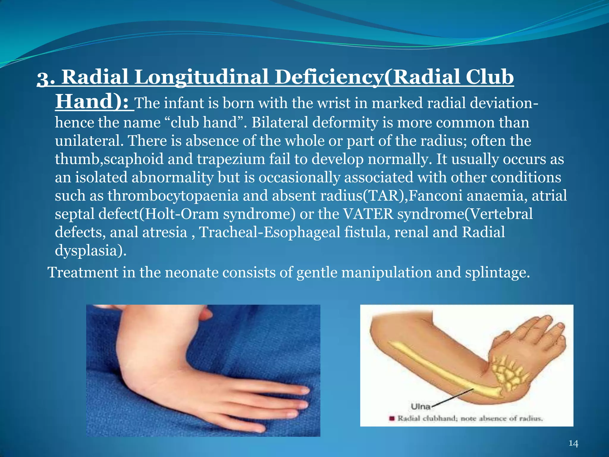 Deformities Of Human Body | PPTX