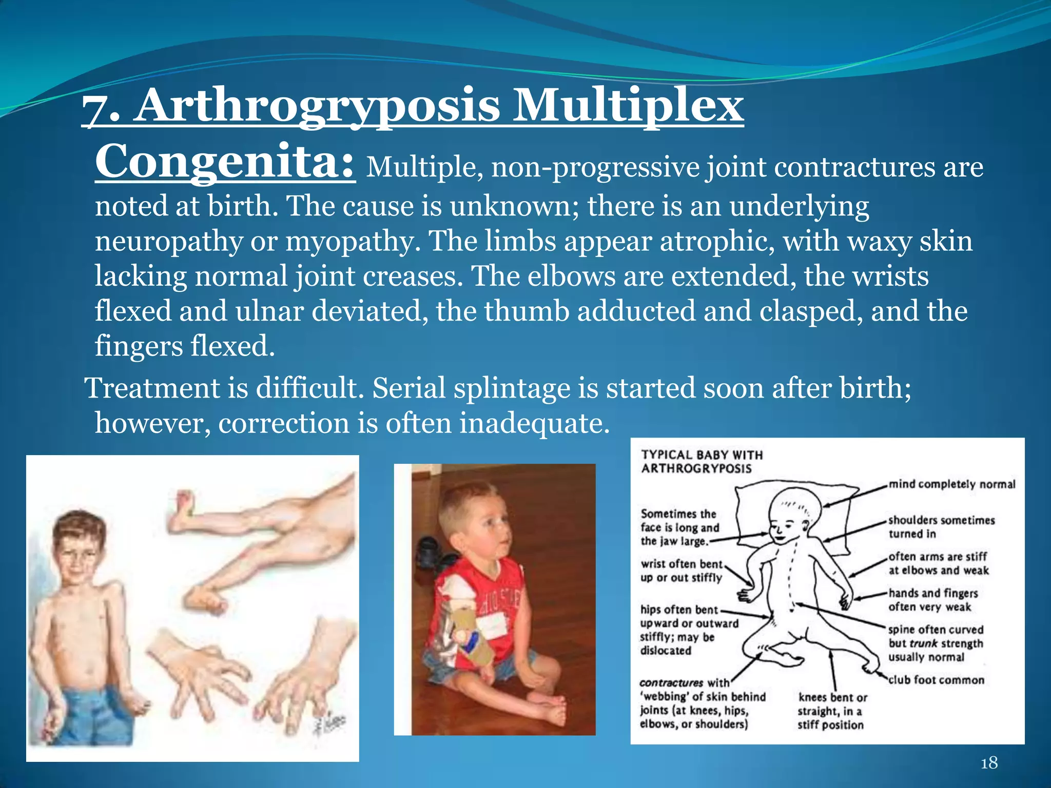 Deformities Of Human Body | PPTX