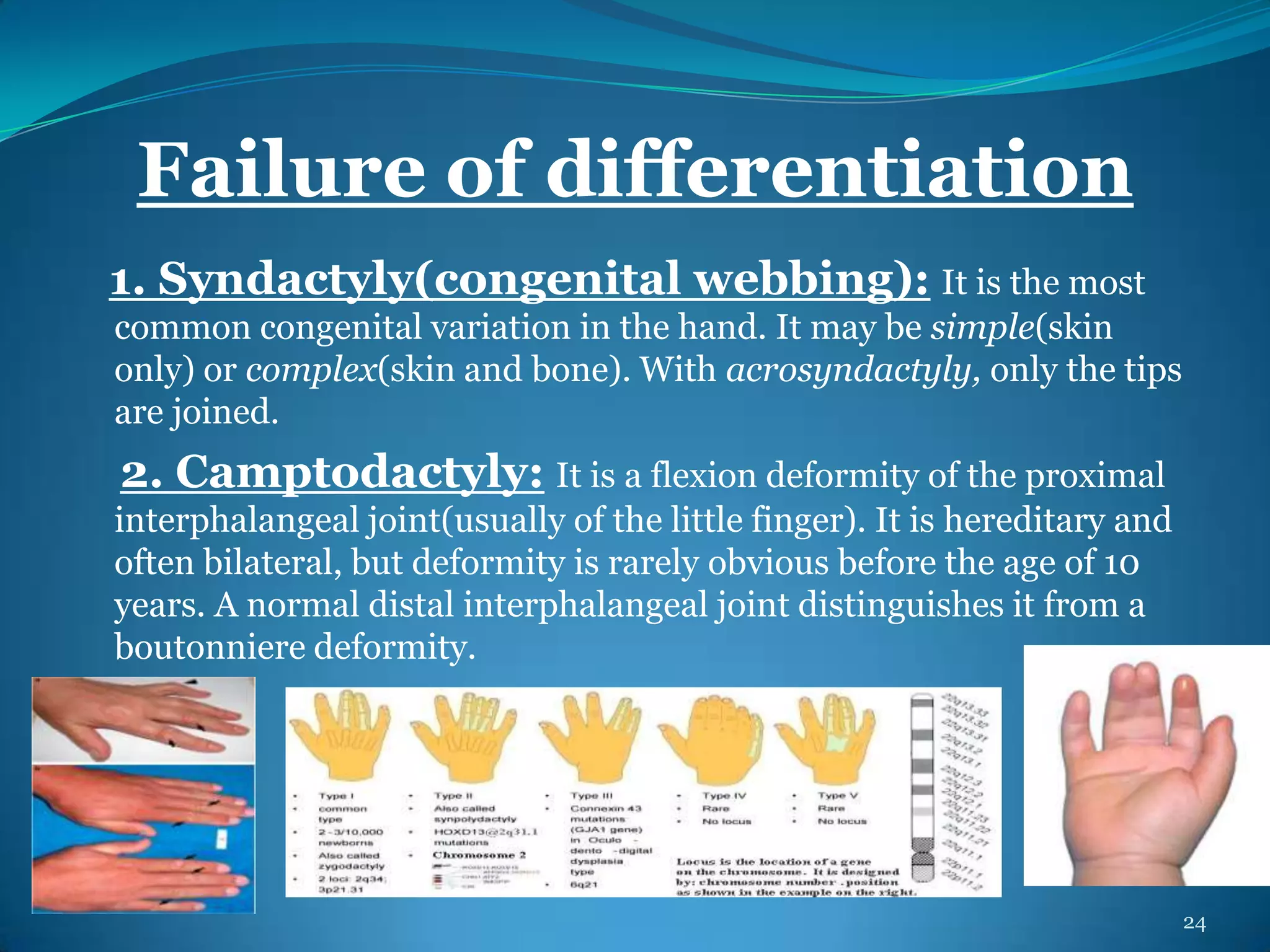 Deformities Of Human Body | PPTX