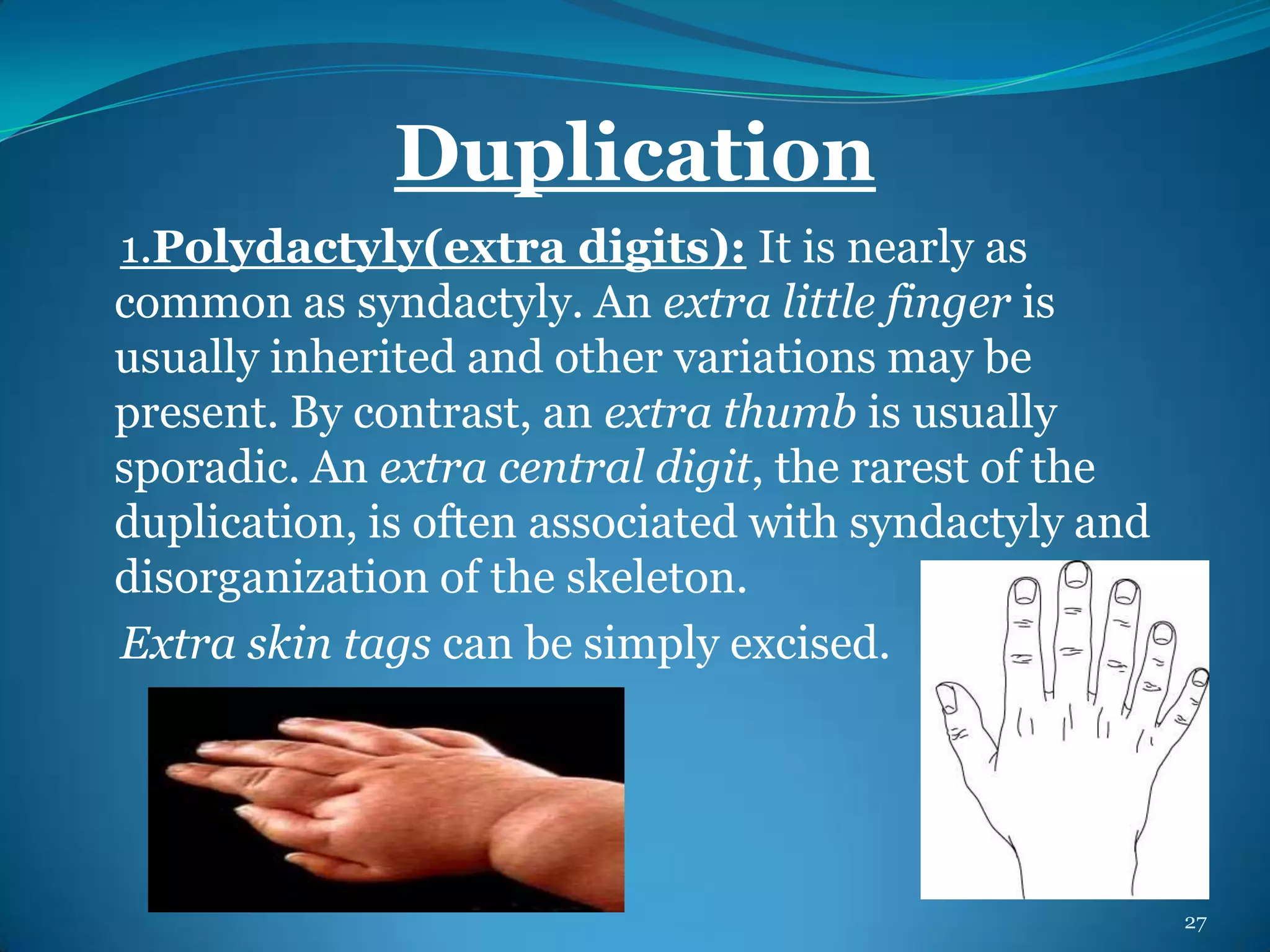 Deformities Of Human Body | PPTX