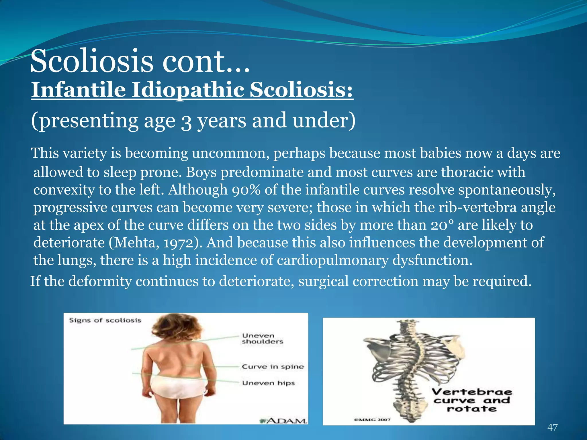 Deformities Of Human Body | PPTX