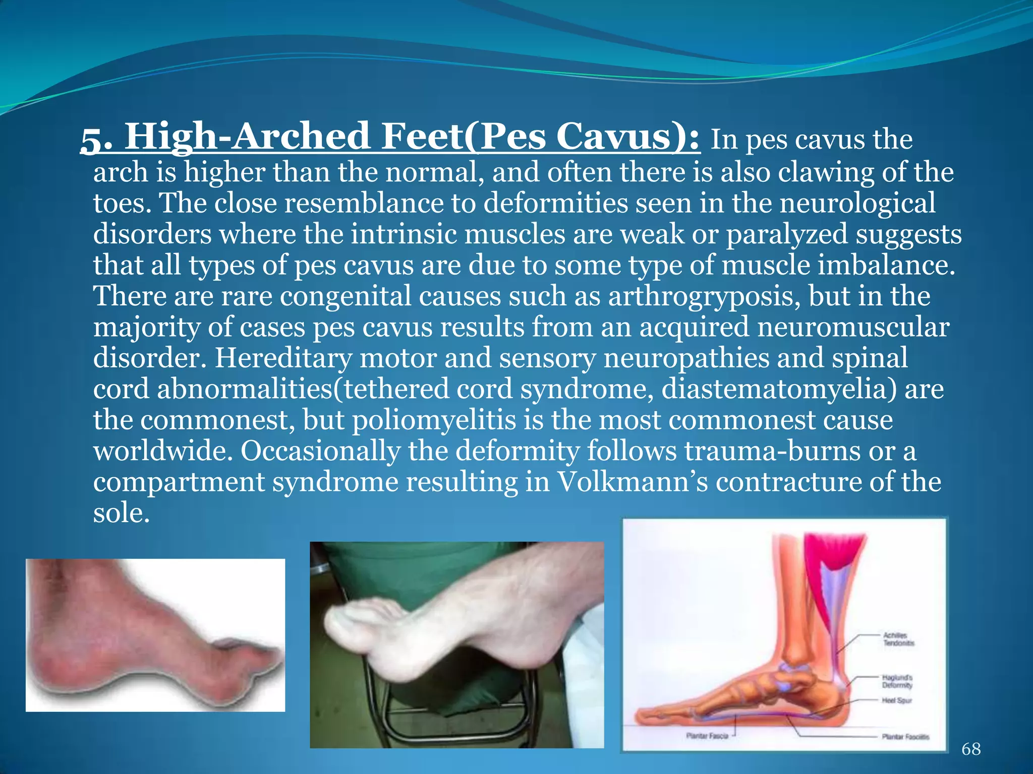 Deformities Of Human Body | PPTX