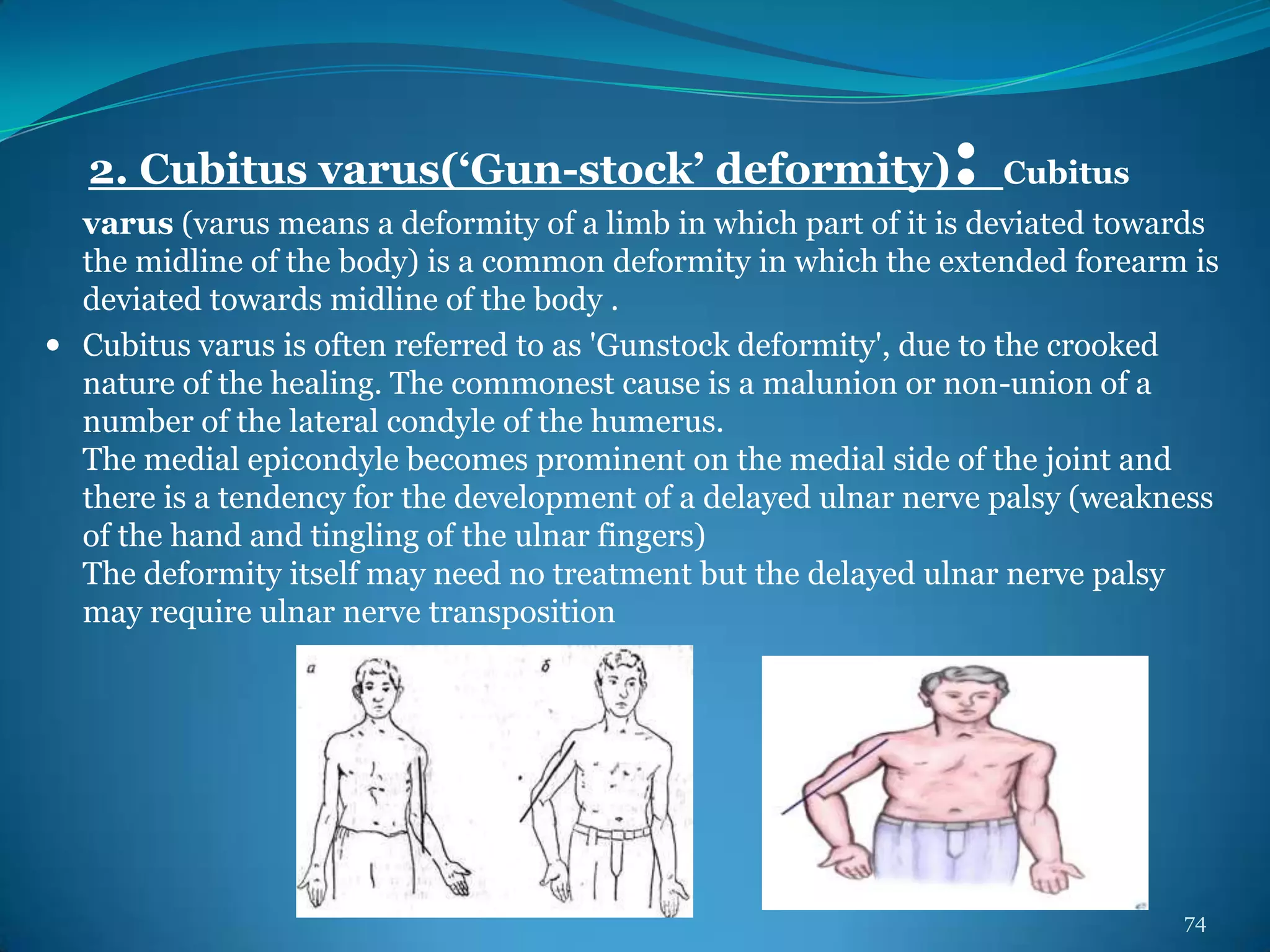 Deformities Of Human Body | PPTX