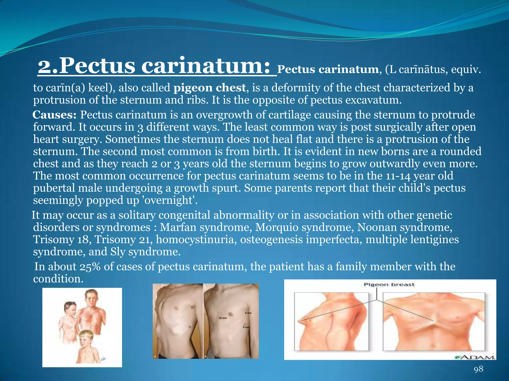 Deformities Of Human Body | PPTX