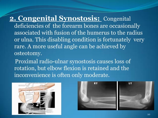 Deformities Of Human Body | PPTX