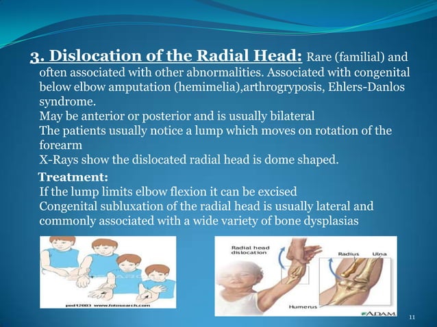 Deformities Of Human Body | PPTX