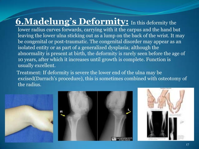 Deformities Of Human Body | PPTX
