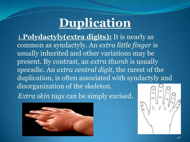 Deformities Of Human Body | PPTX