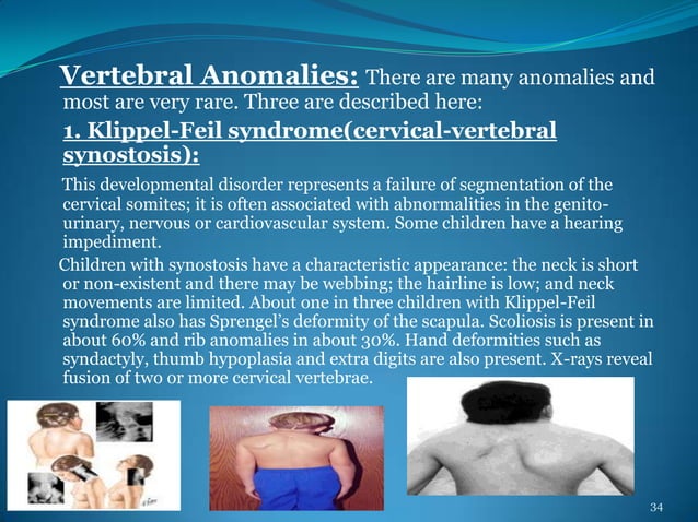 Deformities Of Human Body | PPTX