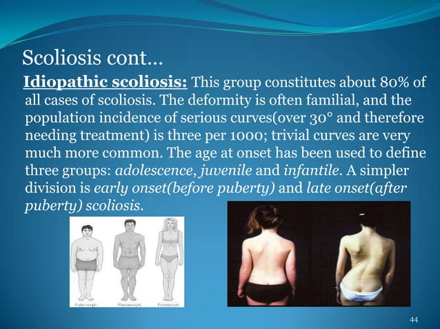 Deformities Of Human Body | PPTX