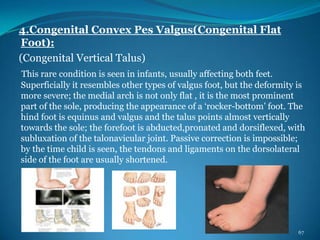 Deformities Of Human Body | PPTX