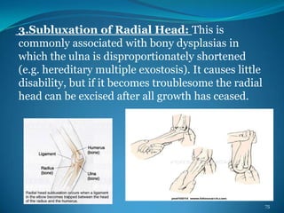 Deformities Of Human Body | PPTX