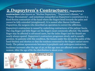 Deformities Of Human Body | PPTX