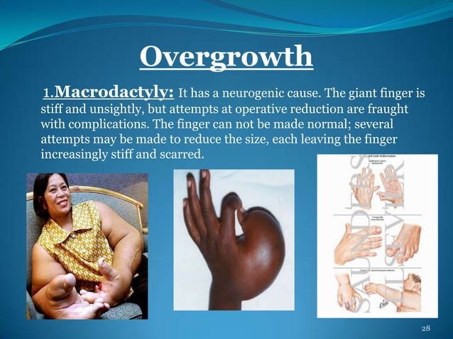 Deformities Of Human Body
