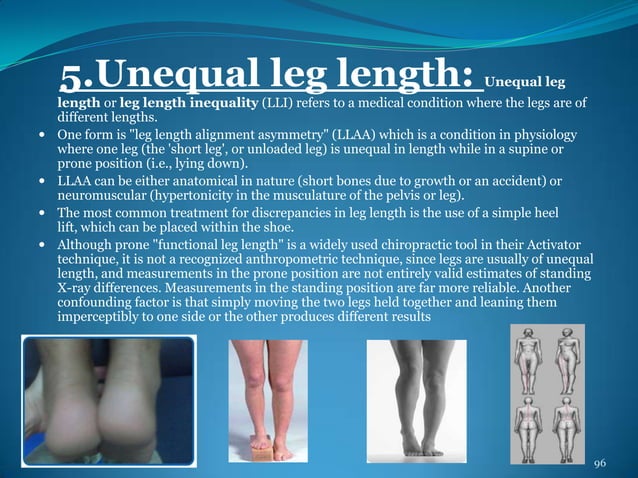 Deformities Of Human Body