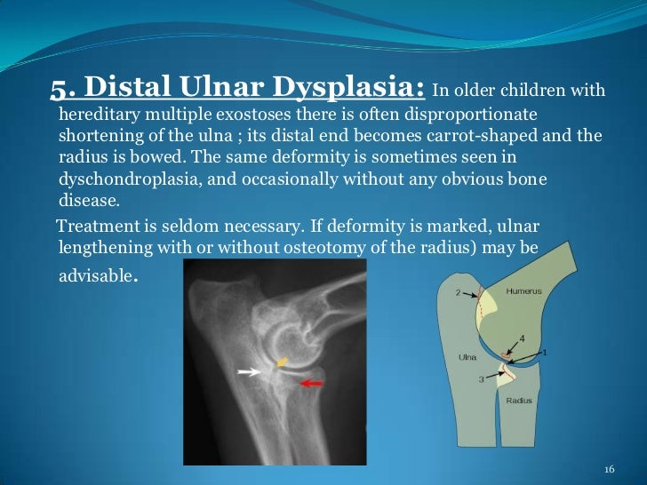 Deformities Of Human Body