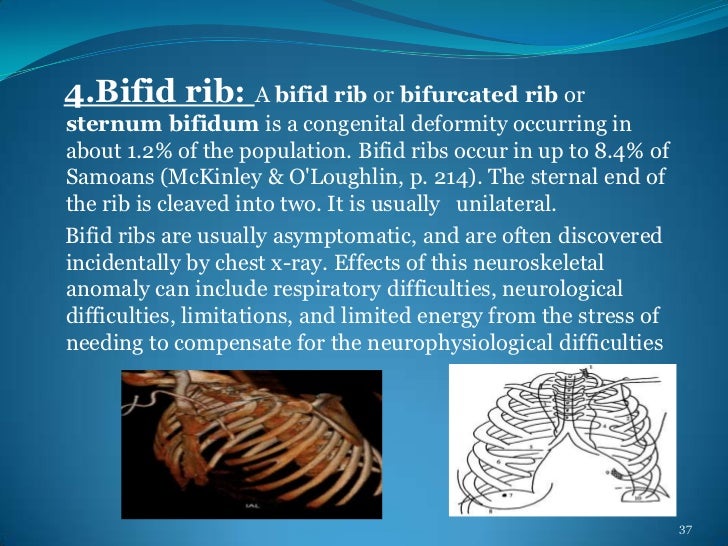 Deformities Of Human Body